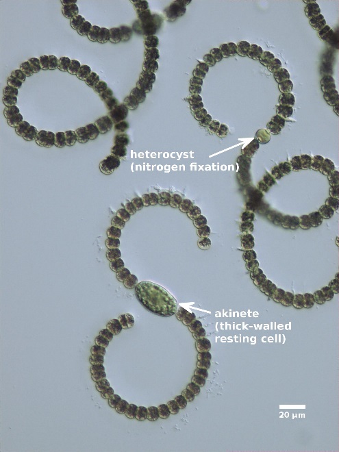 Freshwater Algae in Northwest Washington - a Beginner's Guide to Algae ...