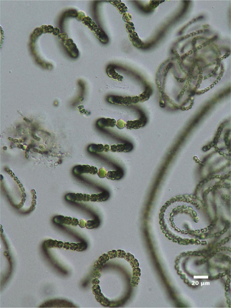 Understanding toxic cyanobacteria –WALPA