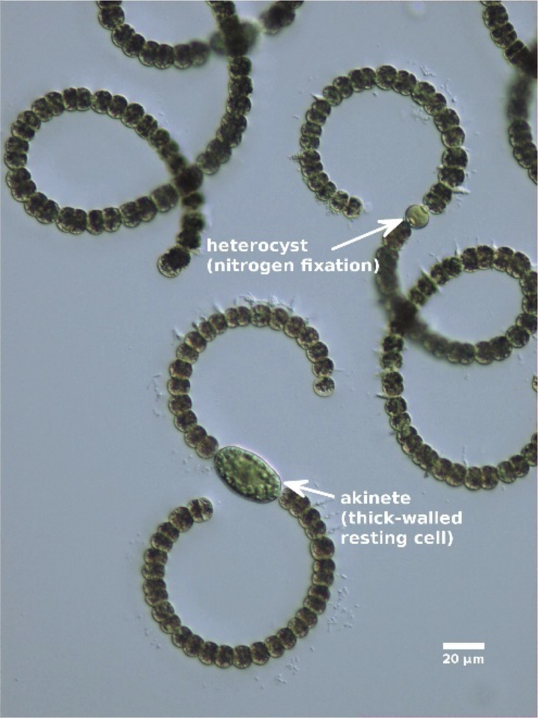 Understanding toxic cyanobacteria –WALPA