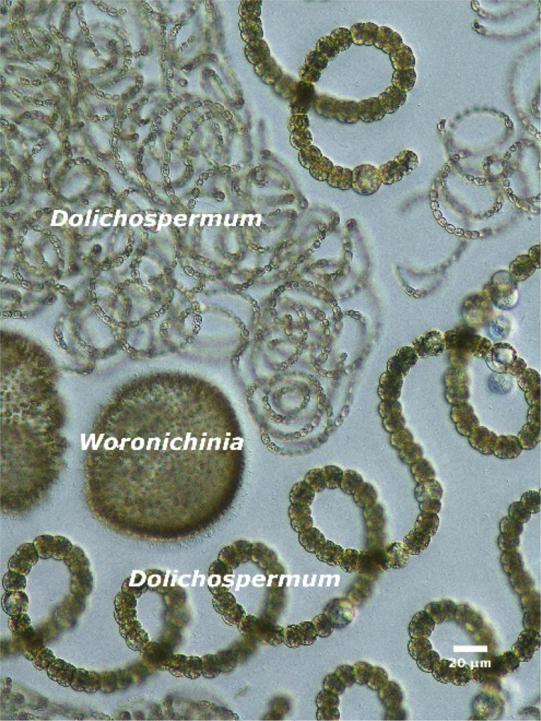 Understanding toxic cyanobacteria –WALPA